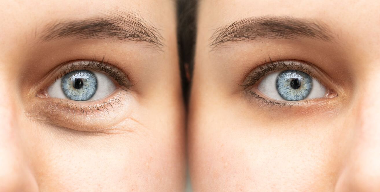 Oculoplastic Surgery - Inland Eye Specialists